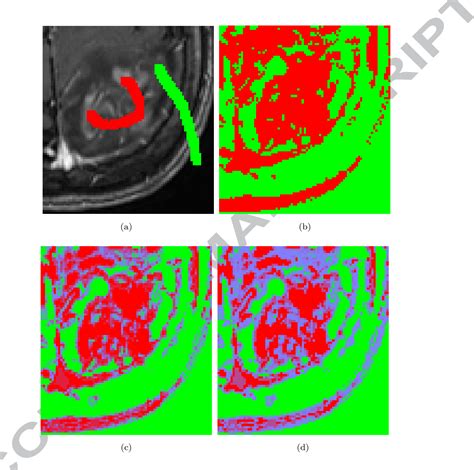 Figure 2 From Integrating Machine Learning With Region Based Active