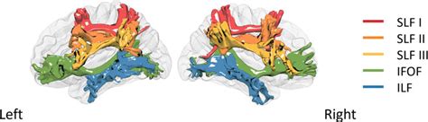 Probabilistic Tractography Of Ten Tracts Of Interest Normalised