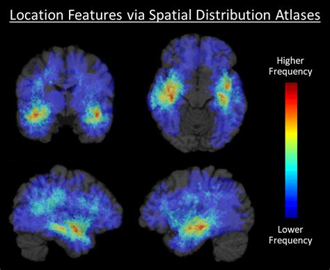 Illustrative Examples Of Spatial Distribution Left And Texture Download Scientific Diagram