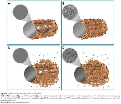 The Synergistic Effect Of Tio2 Nanoporous Modification And Platelet Ri