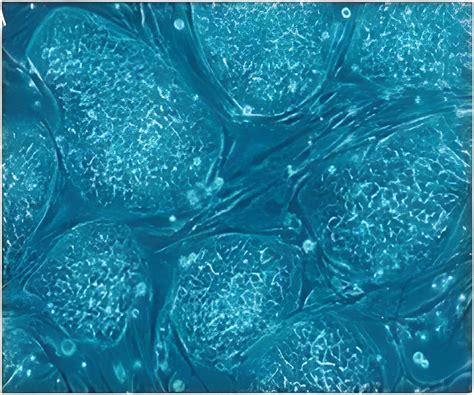 Can Stem Cells Unlock The Mystery Of Alzheimers Disease