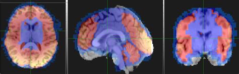 Ghosting In Alignment Afni Message Board Afni Discuss Message Board