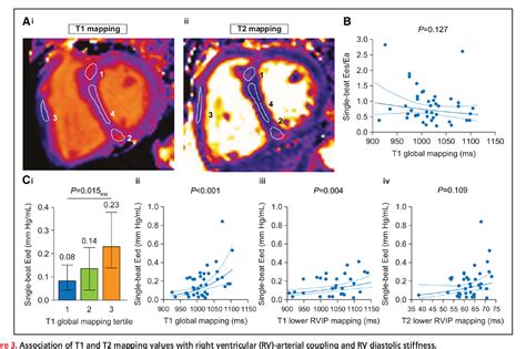 Reserve Of Right Ventricular Arterial Coupling In The Setting Of Chronic Overload Semantic Scholar