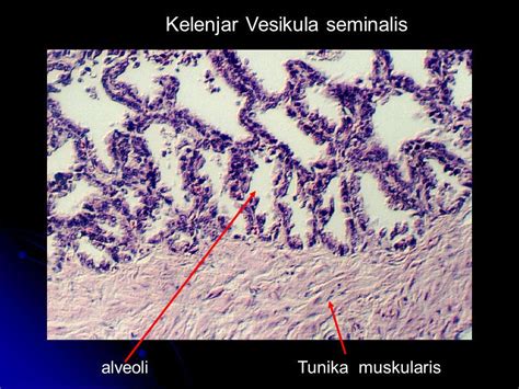 Gambar Vesikula Seminalis 52 Koleksi Gambar