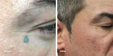 Removing Temporary Tattoos From Face At Cherry Jones Blog