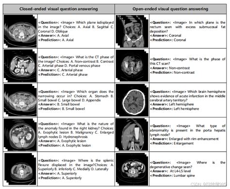 基于mllms的3d医学图像分析（python代码实现数据可视化分析）medmd数据集 Csdn博客