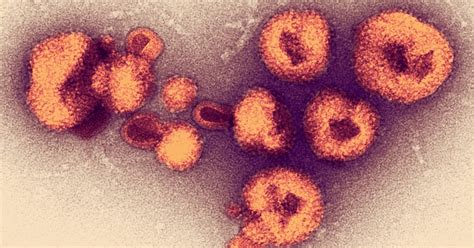 Lassa Fever Carries Little Risk To Public Experts Say The New York Times