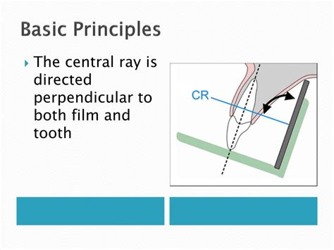 Ppt The Paralleling Technique Part 1 Powerpoint Presentation Free