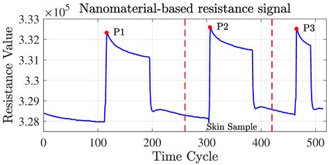 Nanomaterial Based Sensor Array Signal Processing And Tuberculosis