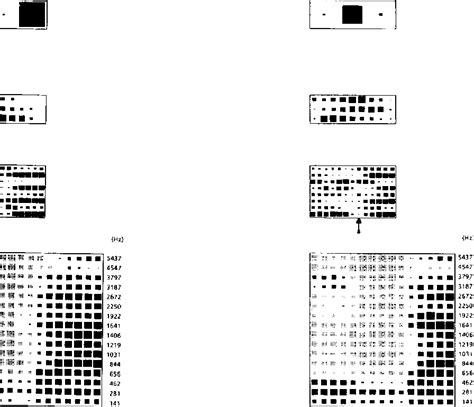 Figure 2 From Phoneme Recognition Using Time Delay Neural Networks