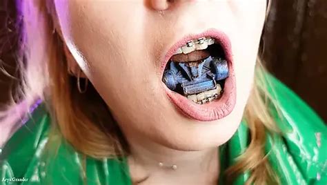 Kostenlose Braces Fetish Porno Videos Von Xhamster