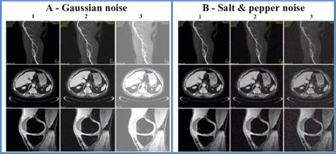 A Gaussian Noise Application To Ct Images 1 Native Image 2 μ 0