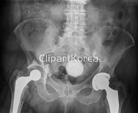 해외작가포토 클립아트코리아 통로이미지주