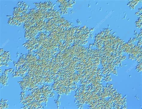 Insulin Crystals Lm Stock Image C0195119 Science Photo Library