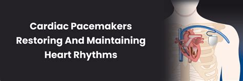 Cardiac Pacemakers Heart Rhythm Restoration
