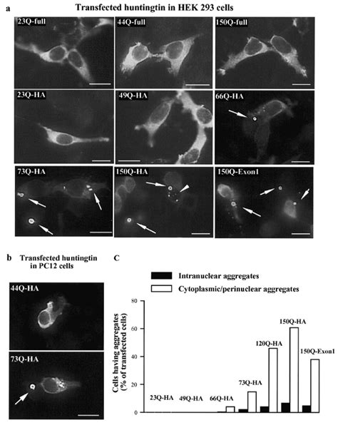 Subcellular Localization Of Huntingtin Aggregates In Transfected Cells
