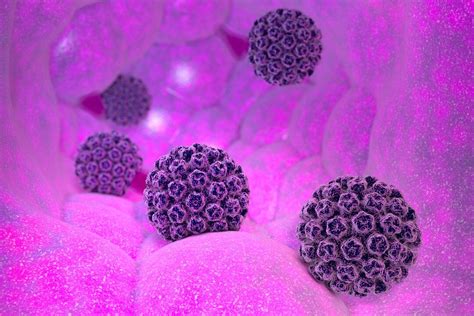 Nih Scientists Find A Type Of Hpv Can Cause Skin Cancer The Epoch Times