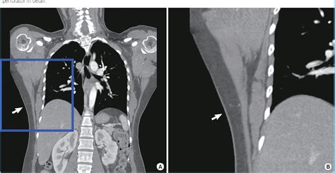Figure 1 From Comparison Of The Multidetector Row Computed Tomographic