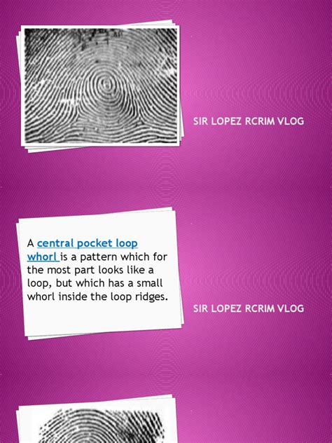 Central Pocket Loop Whorl Explained Pdf