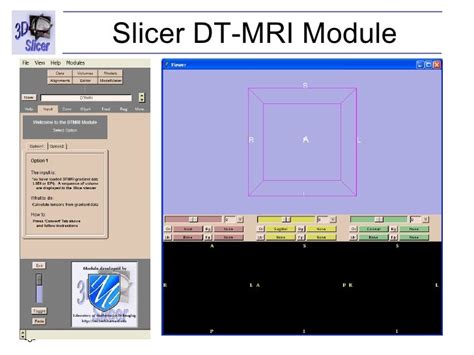 Diffusion Tensor Imaging Analysis 3749