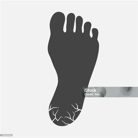 발바닥 과각화증 블랙 아이콘 실루엣 피부 바깥층이 두꺼워지는 발 벡터 건강관리와 의술에 대한 스톡 벡터 아트 및 기타 이미지