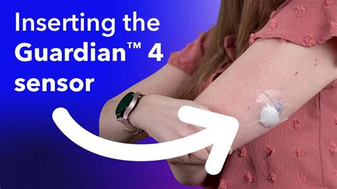 Guardian™ 4 Sensor Sensor And Transmitter Support Medtronic Guardian™ 4 Sensor Sensor And Transmitter Support Medtronic