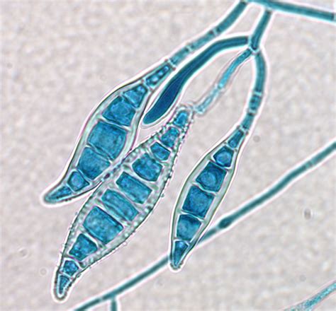 Microculture — Fungal Macroconidia