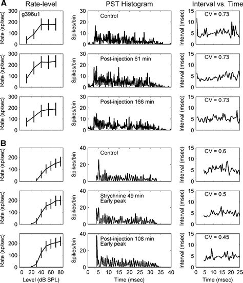 Anteroventral Cochlear Nucleus Semantic Scholar