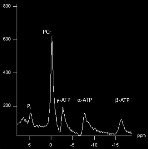 10 Real Part Of Fid Signal In Frequency Domain Download Scientific Diagram