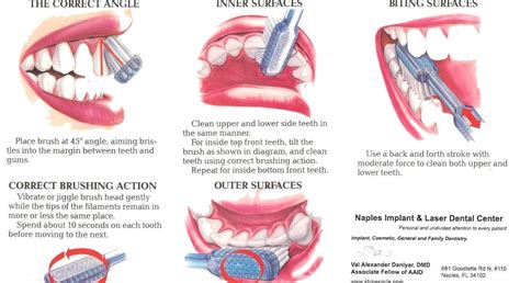 Gingivitis Vs Periodontitis Differences Signs And Therapies
