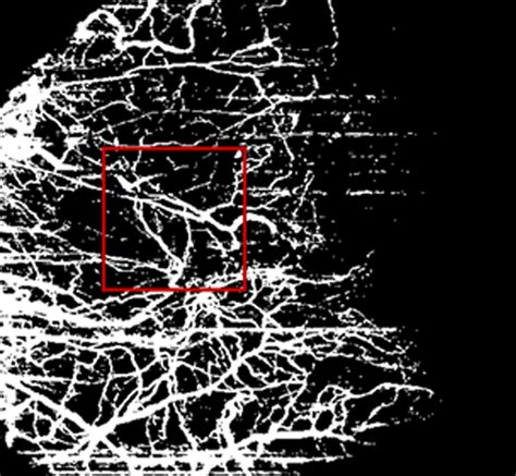 illustration of binary image generated by imagej software for analysis