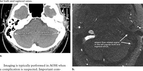 Figure 1 From Interactive Web Based Learning Module On Ct Of The Temporal Bone Anatomy And