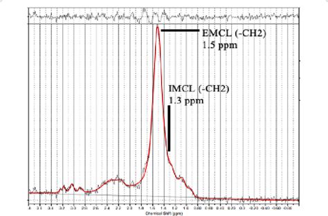 Proton Magnetic Resonance Spectrum Analyzed Using Lcmodel Software Download Scientific Diagram
