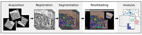 proofreading as part of the connectome workflow electron microscopy