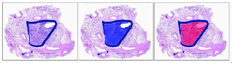 Example Of A Digitized Pen Annotation Left The Original Glass Slide