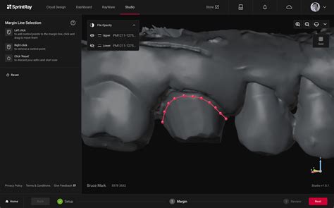 3d Print Dental Restorations With Sprintray Midas