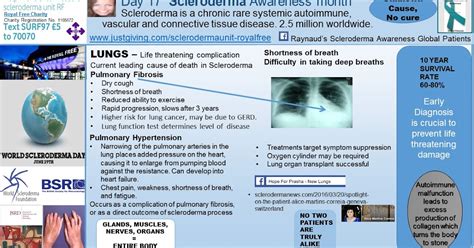 Raynauds Scleroderma Global Patients Day 17 The Lungs Scleroderma Awareness Month 2016