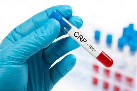 Τι είναι η Crp Healthview Τι είναι η Crp Healthview