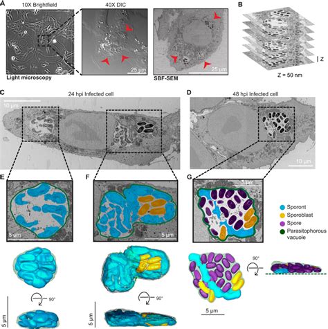 Sbf Sem Of Vero Cells Infected With E Intestinalis A Representative