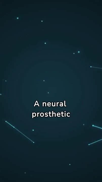 [video] Mohamed El Shazly On Linkedin Neural Prosthetic Device Can