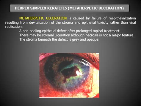 Grodno State Medical University Diagnosis And Treatment Ppt Video Online Download