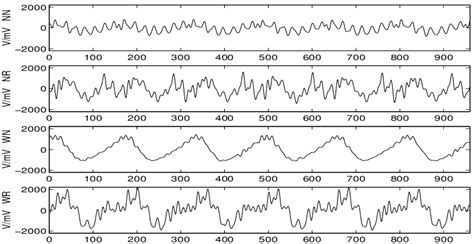 Vibration Time Series For Machine Conditions Download Scientific Diagram