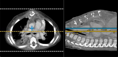 Definition Of Patient Isocenter A Axial Image Binarized With The Ct