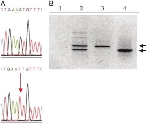 Sequence And Mutation Detection Analysis Of G1238t A Sequence Download Scientific Diagram