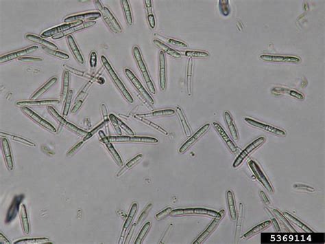 Mycosphaerella Alchetron The Free Social Encyclopedia