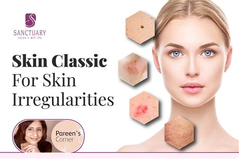 Skin Classic For Skin Irregularities — Sanctuary Salon And Med Spa