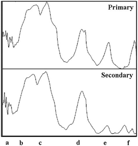 Densitometry Plots For The Sds Page Gel The Densitometry Analysis Was