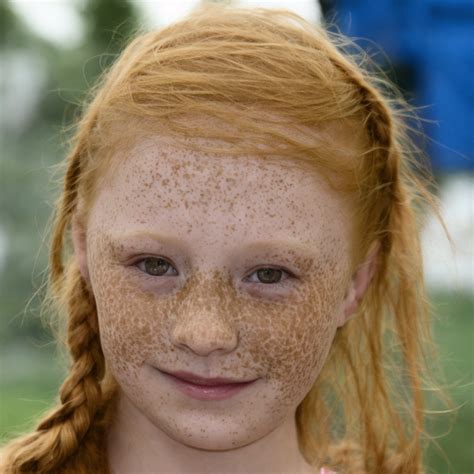 Freckles Weird Freckles Ginger With Freckles Faces