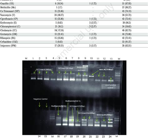 The Electrophoresis Of Pcr Products From Sccmec Typing And Meca And Pvl