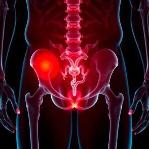 Icd 10 Codes For Inguinal Hernias Wmwtl